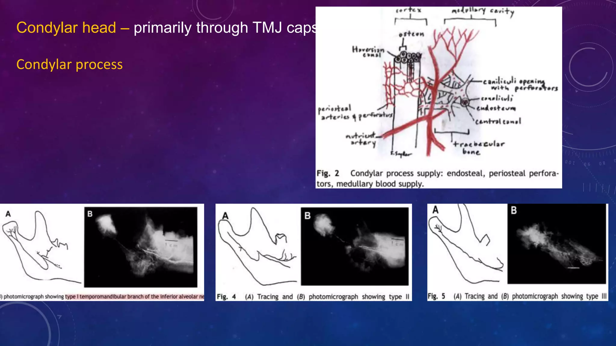 Management of Mandibular Condyle fracture | PPTX