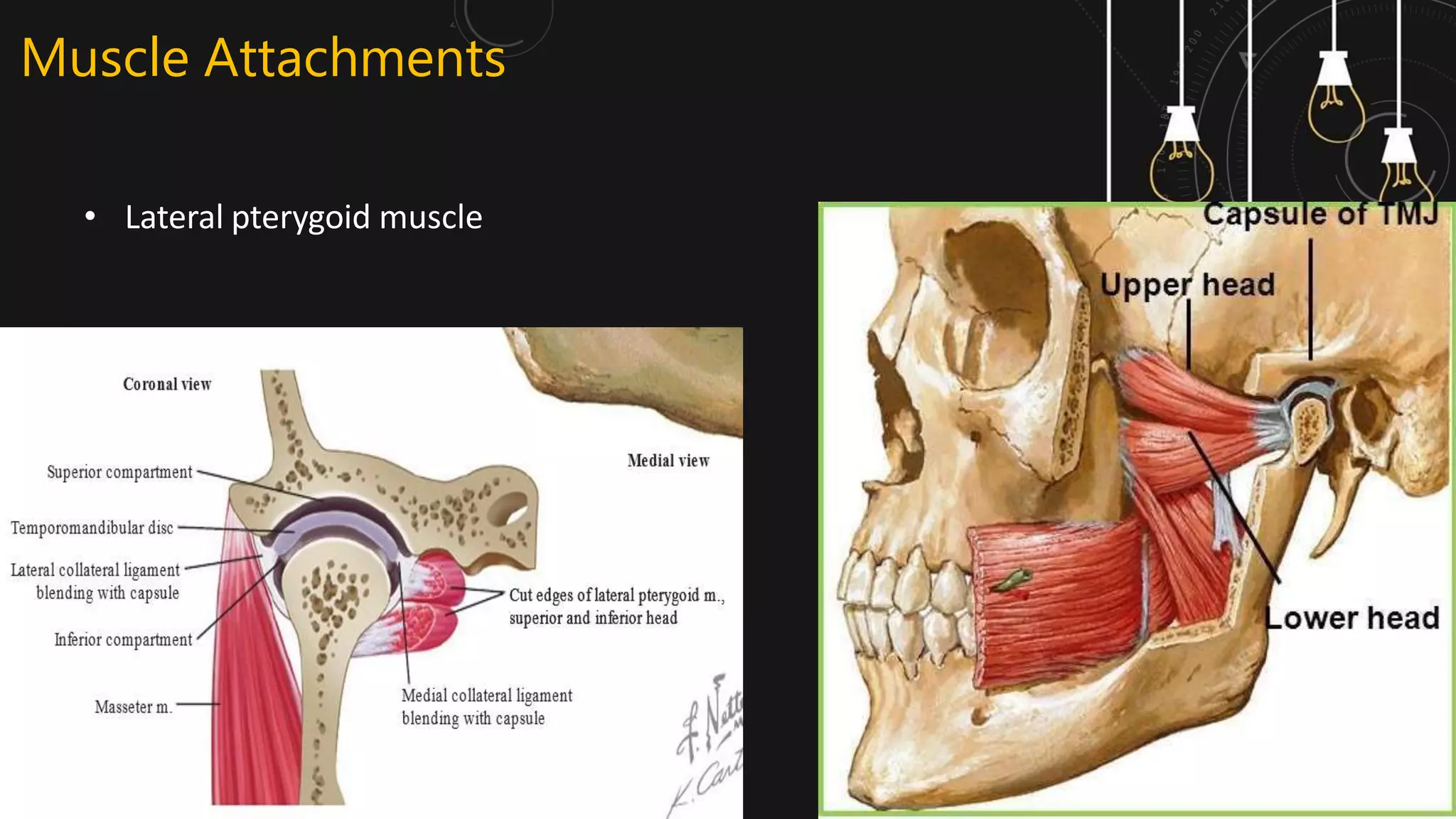 Management of Mandibular Condyle fracture | PPTX
