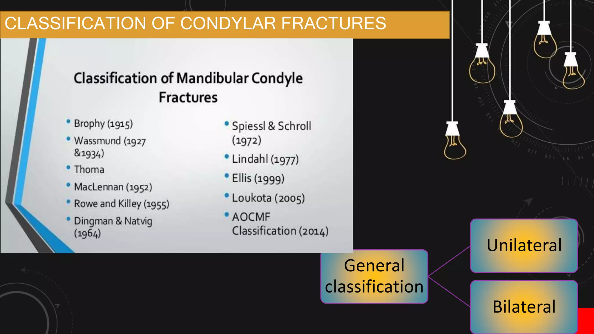 Management of Mandibular Condyle fracture | PPTX