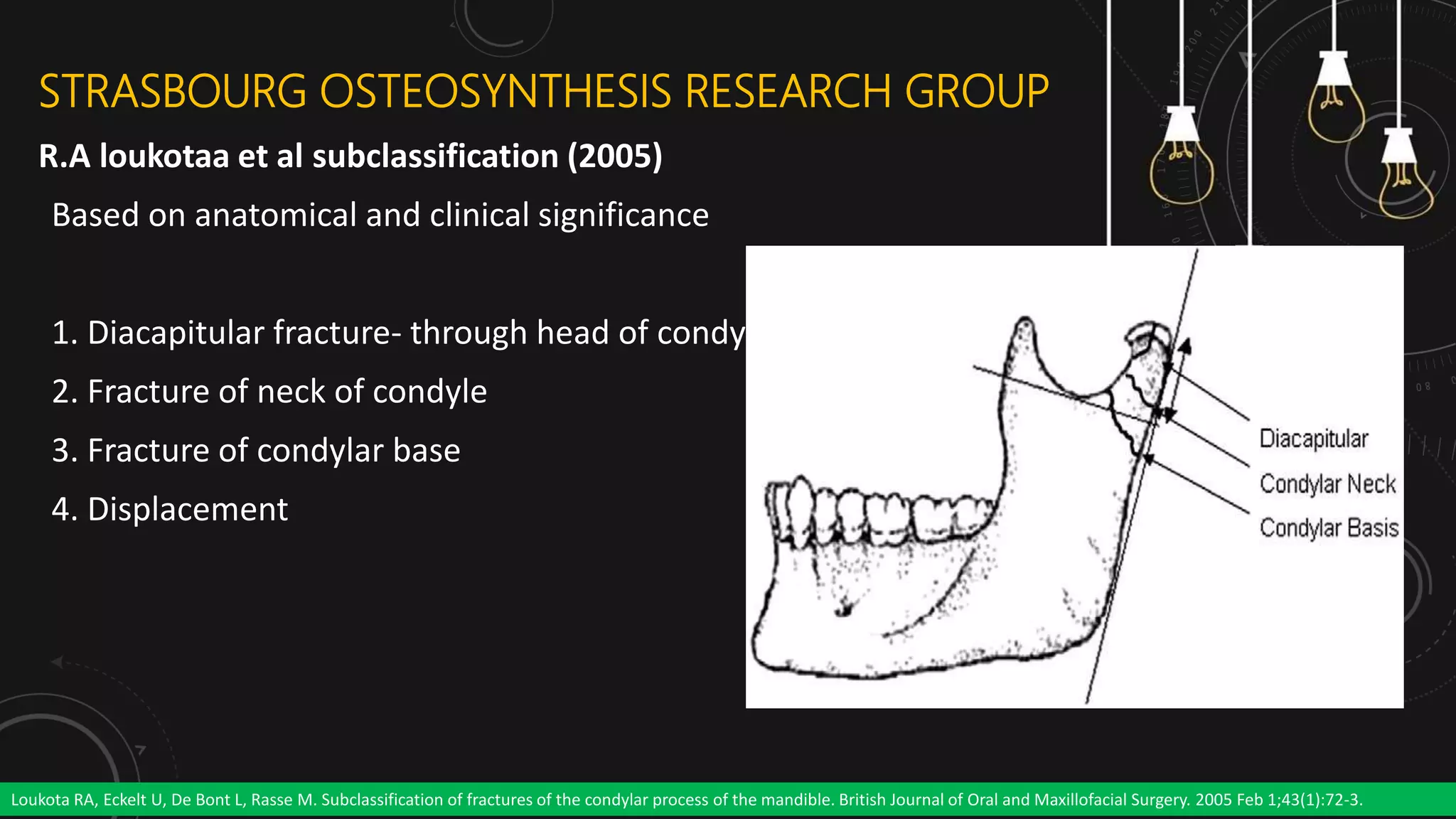 Management of Mandibular Condyle fracture | PPTX