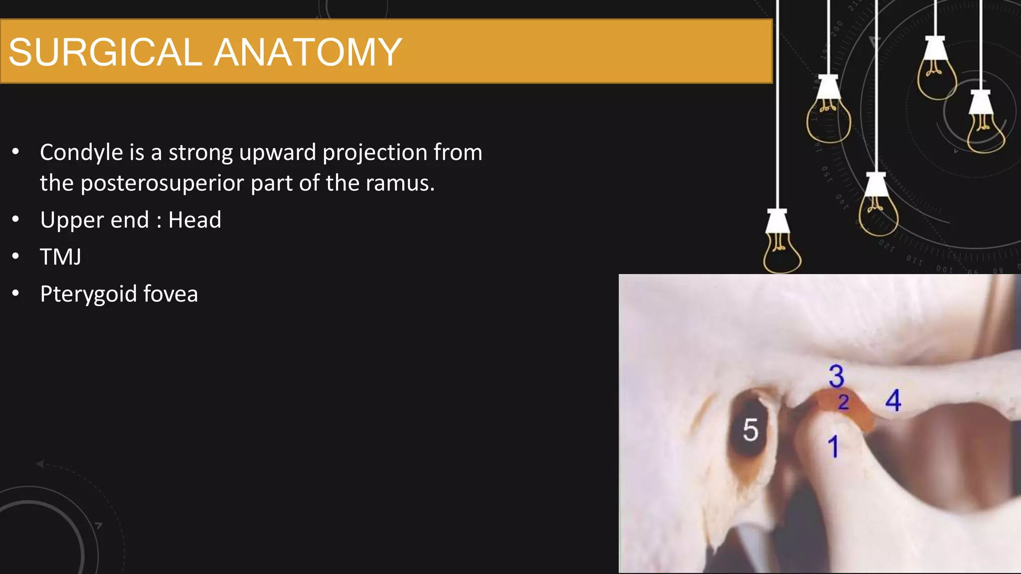 Management of Mandibular Condyle fracture | PPTX