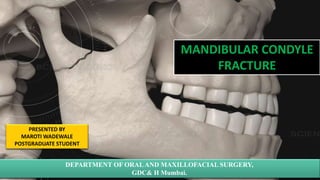 Management of Mandibular Condyle fracture | PPTX