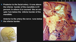 Management of Mandibular Condyle fracture | PPTX