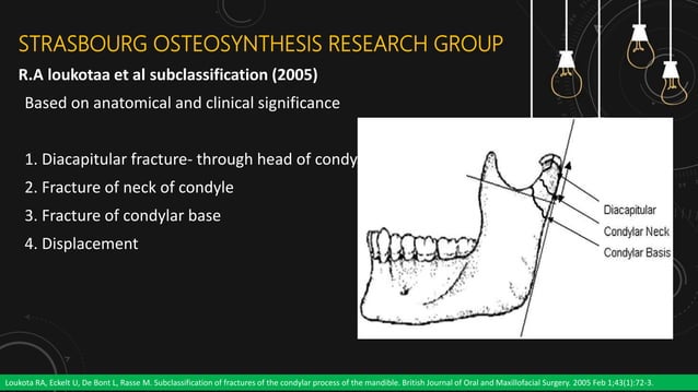 Management of Mandibular Condyle fracture | PPTX | Death, Injury, or ...