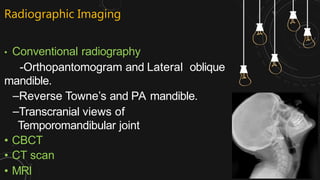 Management of Mandibular Condyle fracture | PPTX