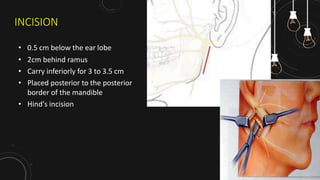 Management of Mandibular Condyle fracture | PPTX