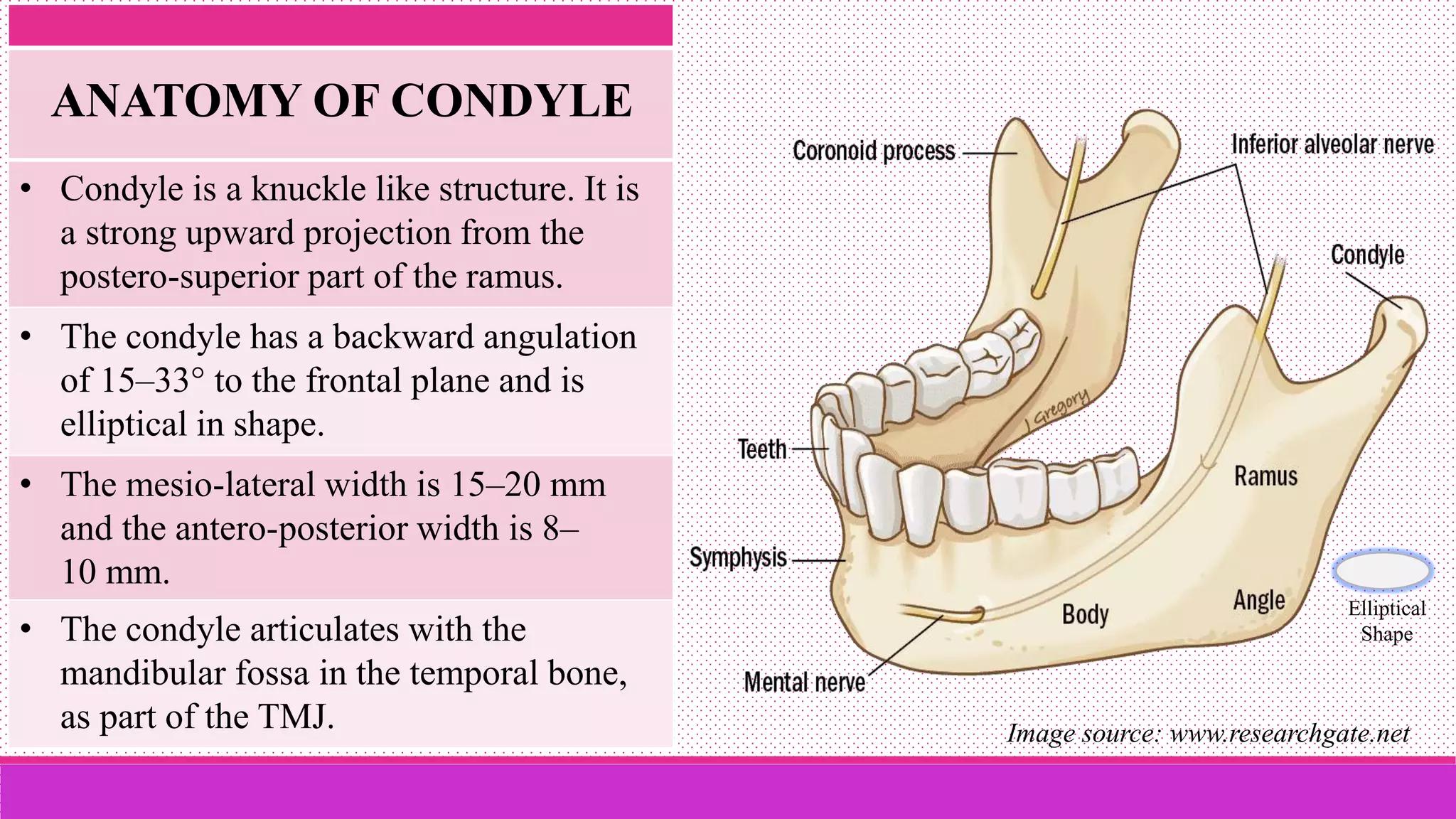 Condyle Fractures.pptx