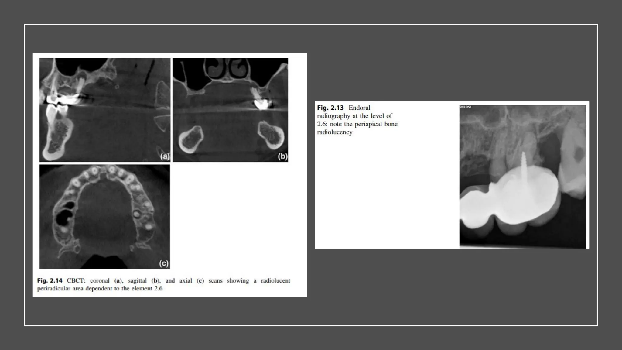 Cone beam CT: Concepts and applicationss.pdf