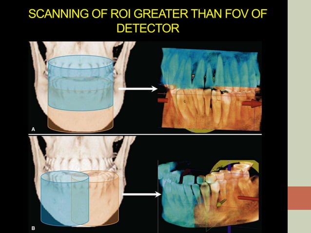 Cone beam computed tomography | PPTX