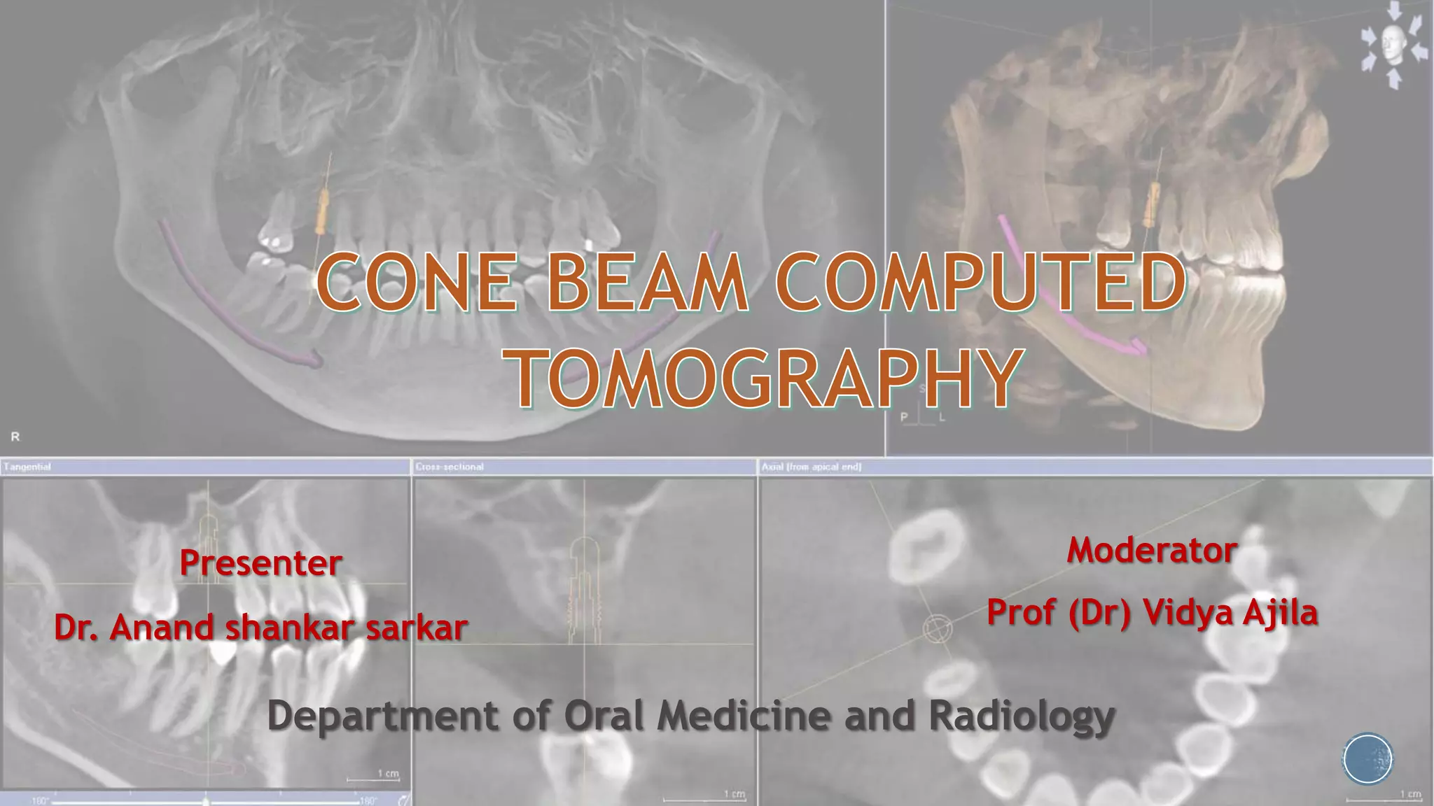 Cone Beam Computed Tomography Pptx