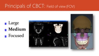Cone beam computed tomography by dr. maryam salman | PPTX