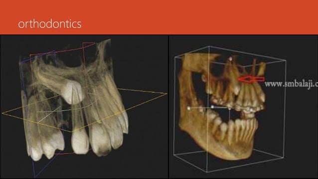 Cone beam computed tomography by dr. maryam salman | PPTX