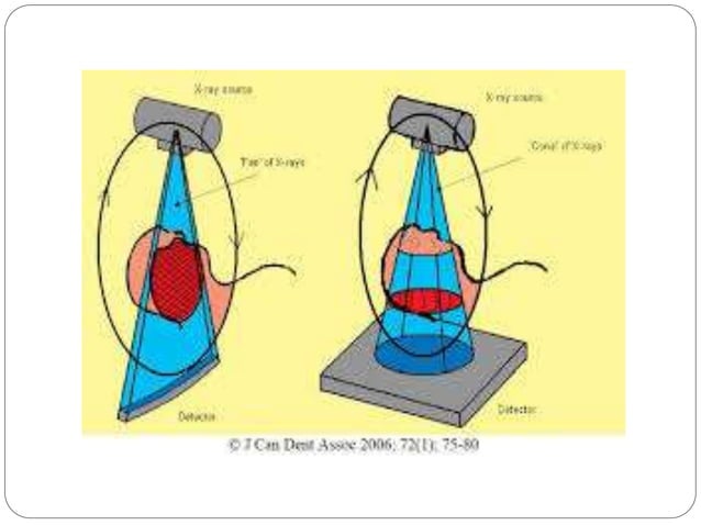 Cone beam computerized tomography mamita | PPTX