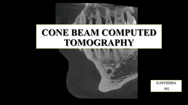 Cone beam ct | PPTX