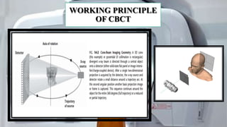 Cone beam ct | PPTX