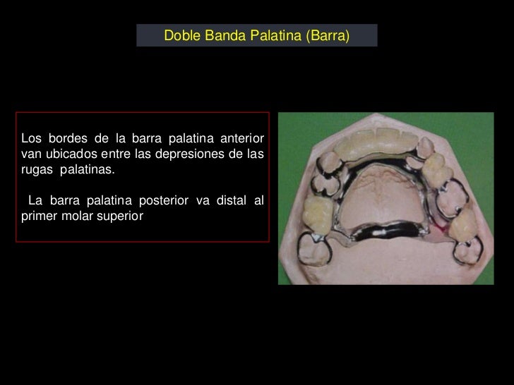 Conectores PPR