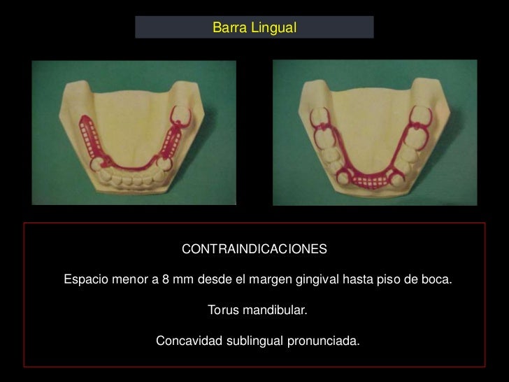 Conectores PPR