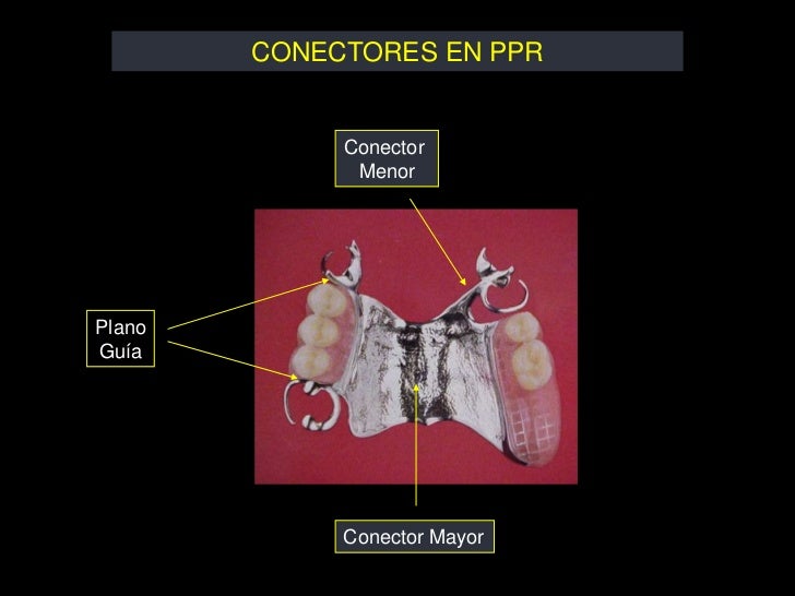 Conectores PPR