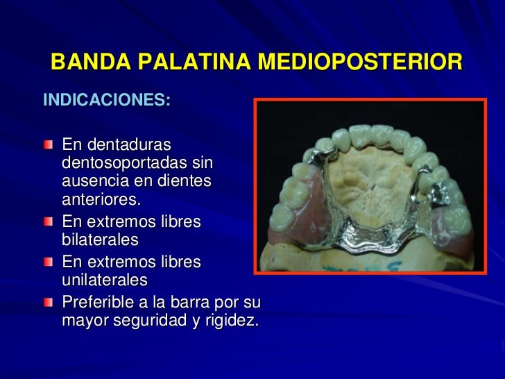 Conectores Mayores Y Apoyos