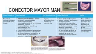 PPR CONECTOR MAYOR Y CONECTOR MENOR | PPTX