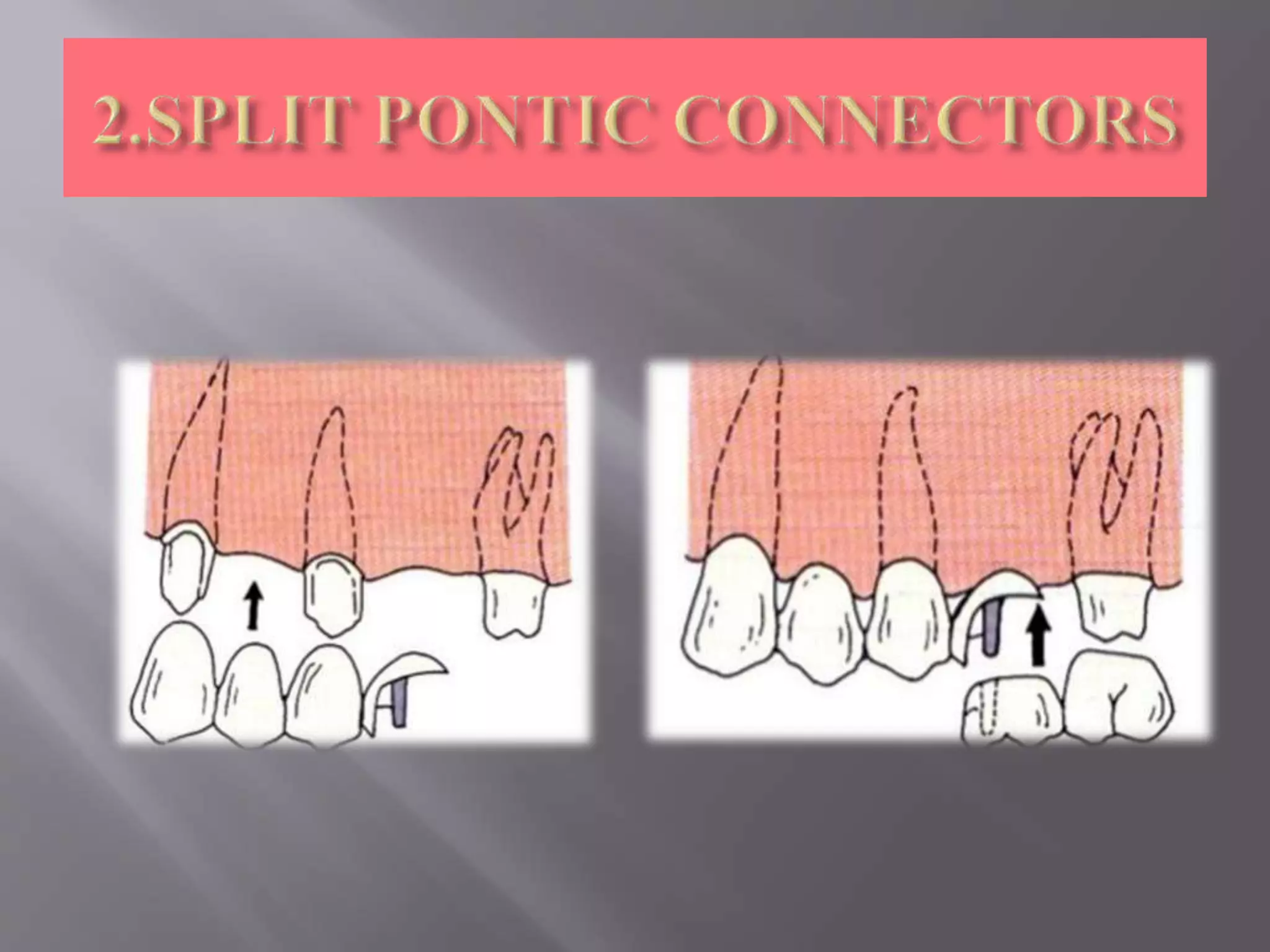 Conectors in fpd | PPTX