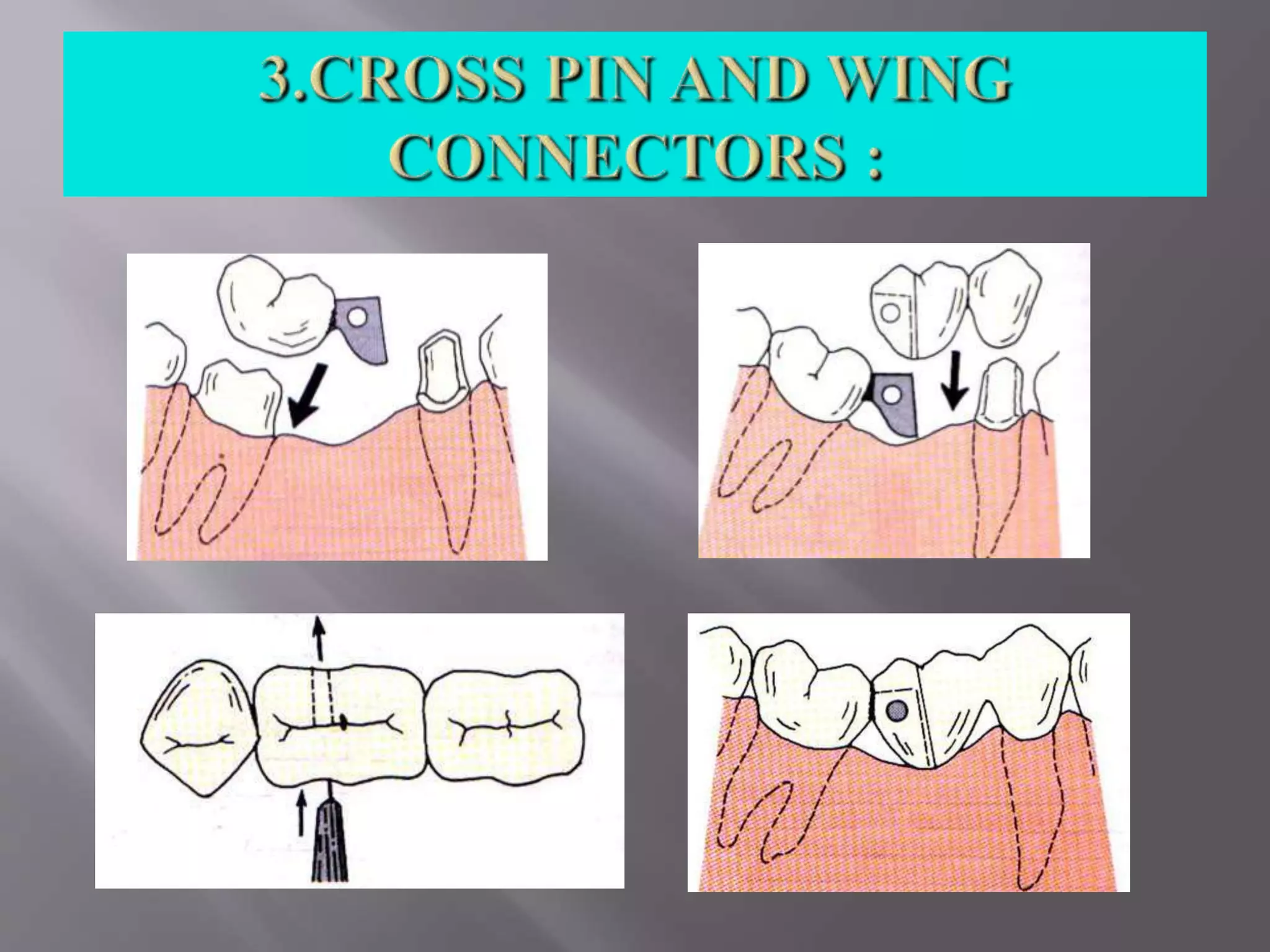 Conectors in fpd | PPTX