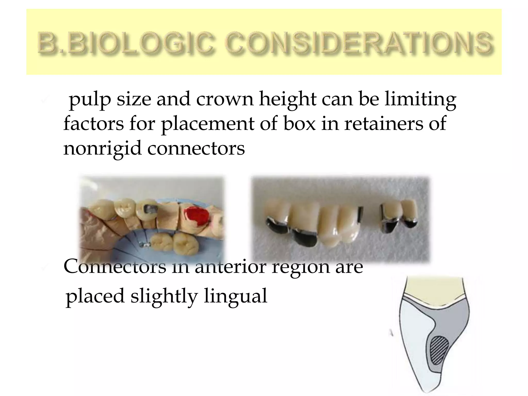 Conectors in fpd | PPTX