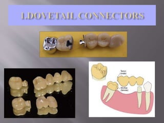 Conectors in fpd | PPTX