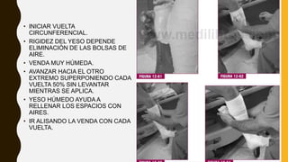 CONFECION Y TIPOS YESOS.pptx