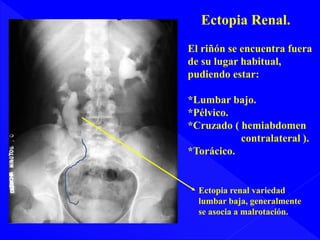 RADIOLOGIA - Conferencia de renal. | PPT