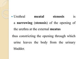 Confenital abnormalities of kidney | PPT