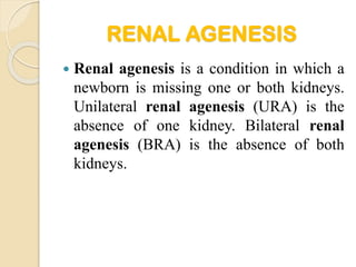 Confenital abnormalities of kidney | PPTX