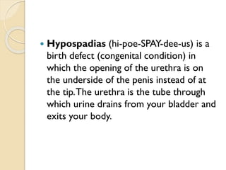 Confenital abnormalities of kidney | PPT