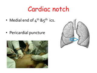 Anatomy of the lung | PPTX