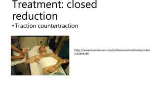 Conference ant shoulder dislocation | PPTX