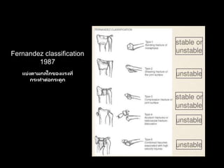 Conference der | PPTX
