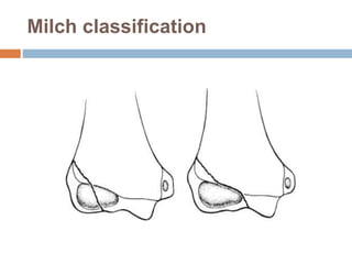 Conference ext.อิศรา เย็นยุวดี (เต้ย รพ.รามา) | PPTX