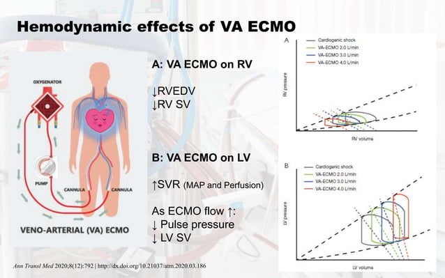 2022 Conference hemodynamic monitoring in VA ECMO