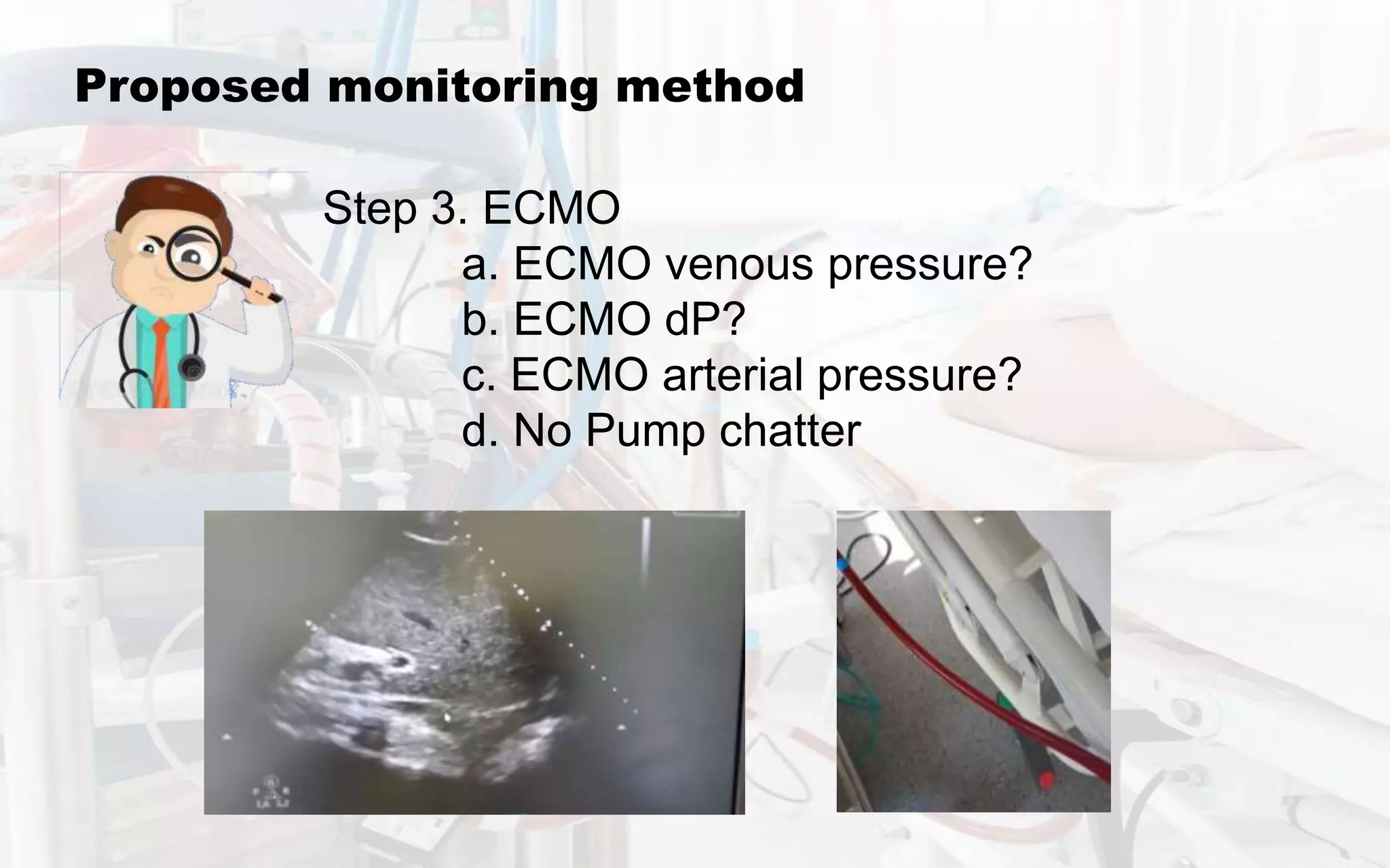 2021 Conference hemodynamic monitoring VV ECMO | PPTX