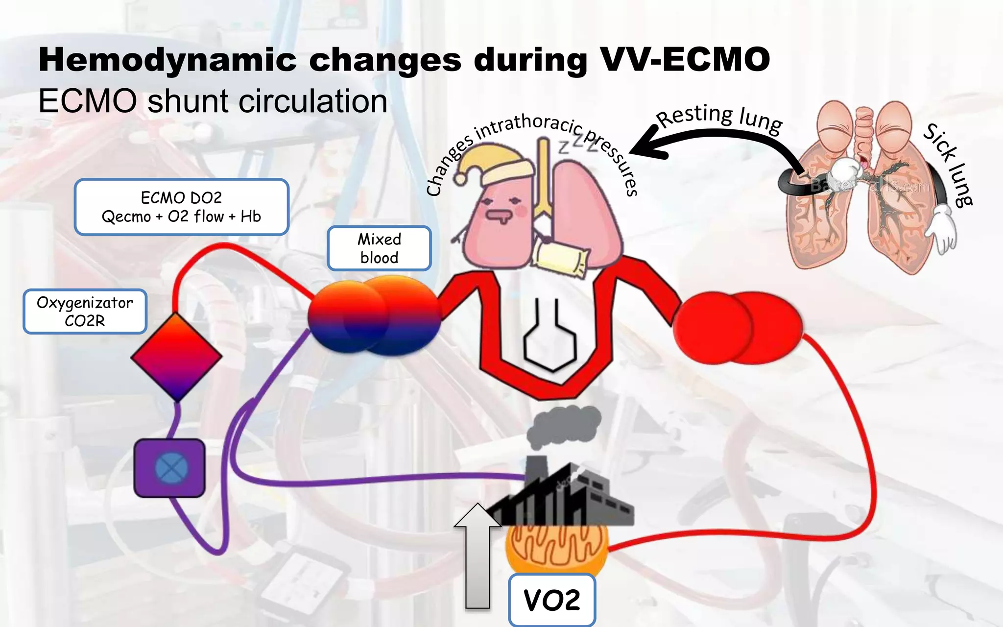 2021 Conference hemodynamic monitoring VV ECMO | PPTX