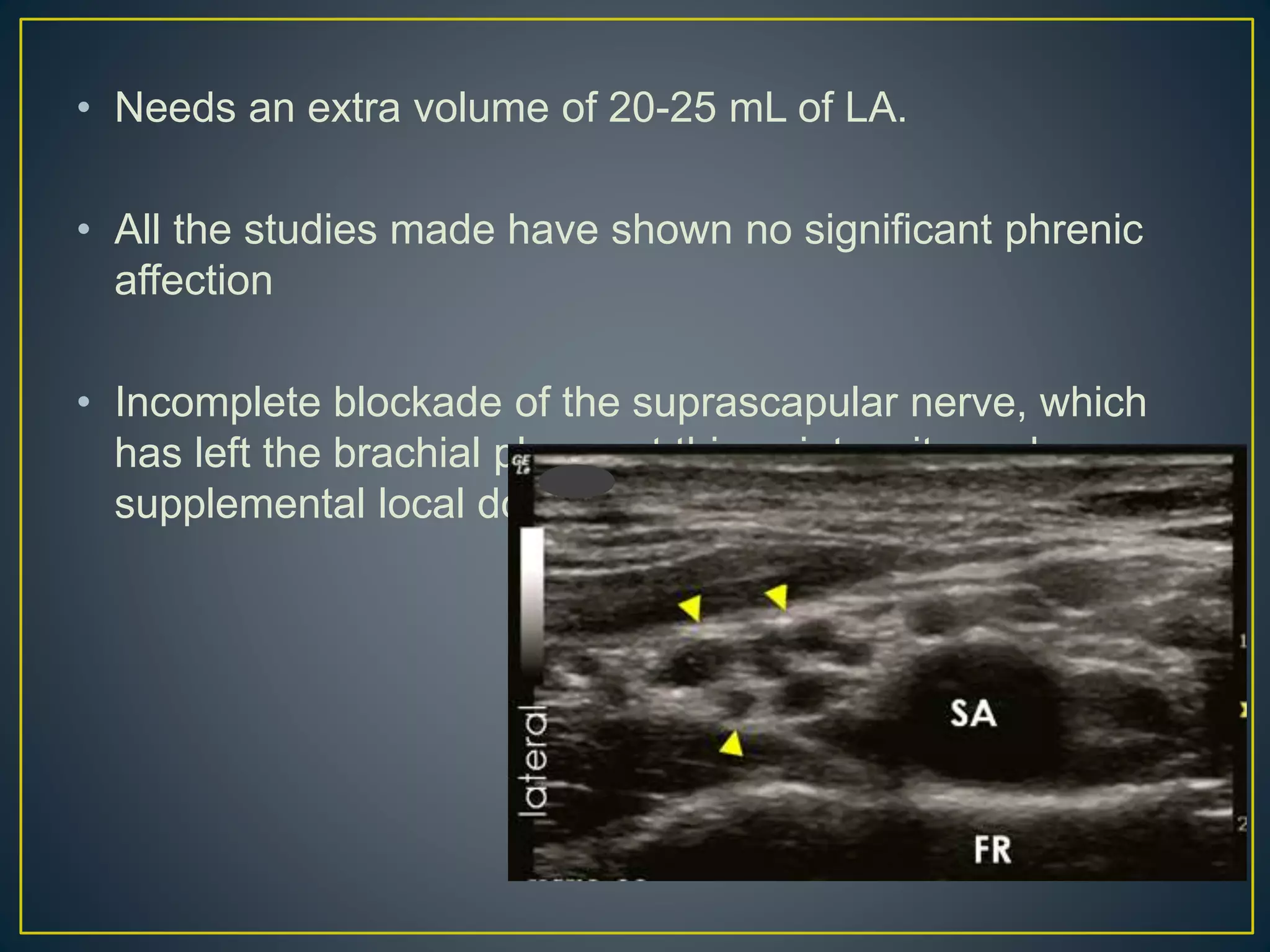 regional anesthesia in shoulder arthroscopy | PPTX