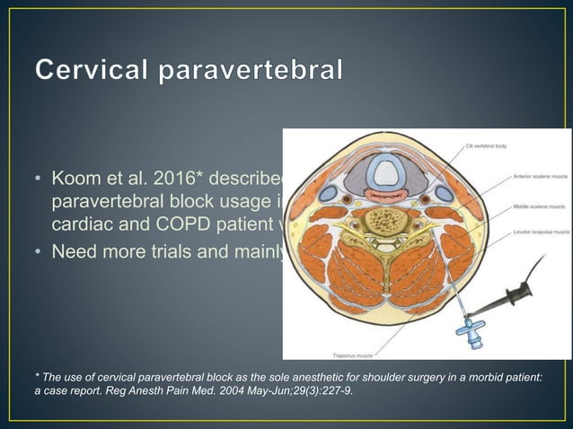 regional anesthesia in shoulder arthroscopy | PPTX | Death, Injury, or ...