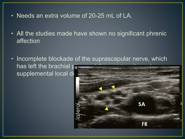 regional anesthesia in shoulder arthroscopy | PPTX | Death, Injury, or ...