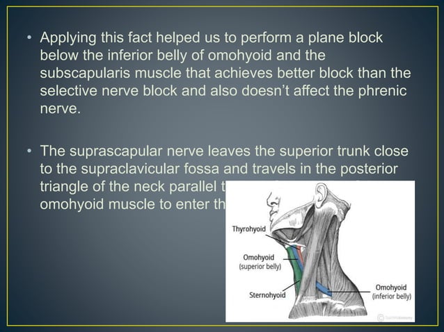 regional anesthesia in shoulder arthroscopy | PPTX | Death, Injury, or ...