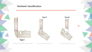 Conference ortho | PPTX