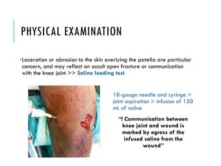 Conference ortho patella fx | PDF | Death, Injury, or Military Conflict ...