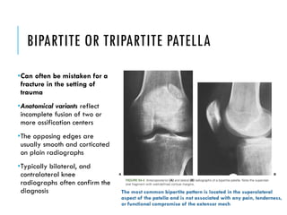 Conference ortho patella fx | PDF | Death, Injury, or Military Conflict ...