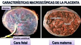 Estudio Morfofuncional y Fisiológico de la Placenta Humana: Desarrollo ...