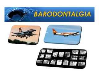 Barodontalgia, Reporte de Siete Casos en Vuelo Real y Simulado | PDF