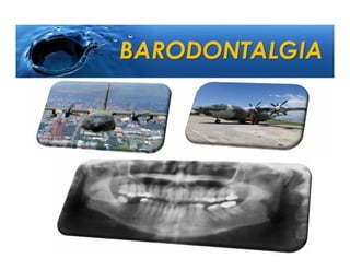 Barodontalgia, Reporte de Siete Casos en Vuelo Real y Simulado | PDF